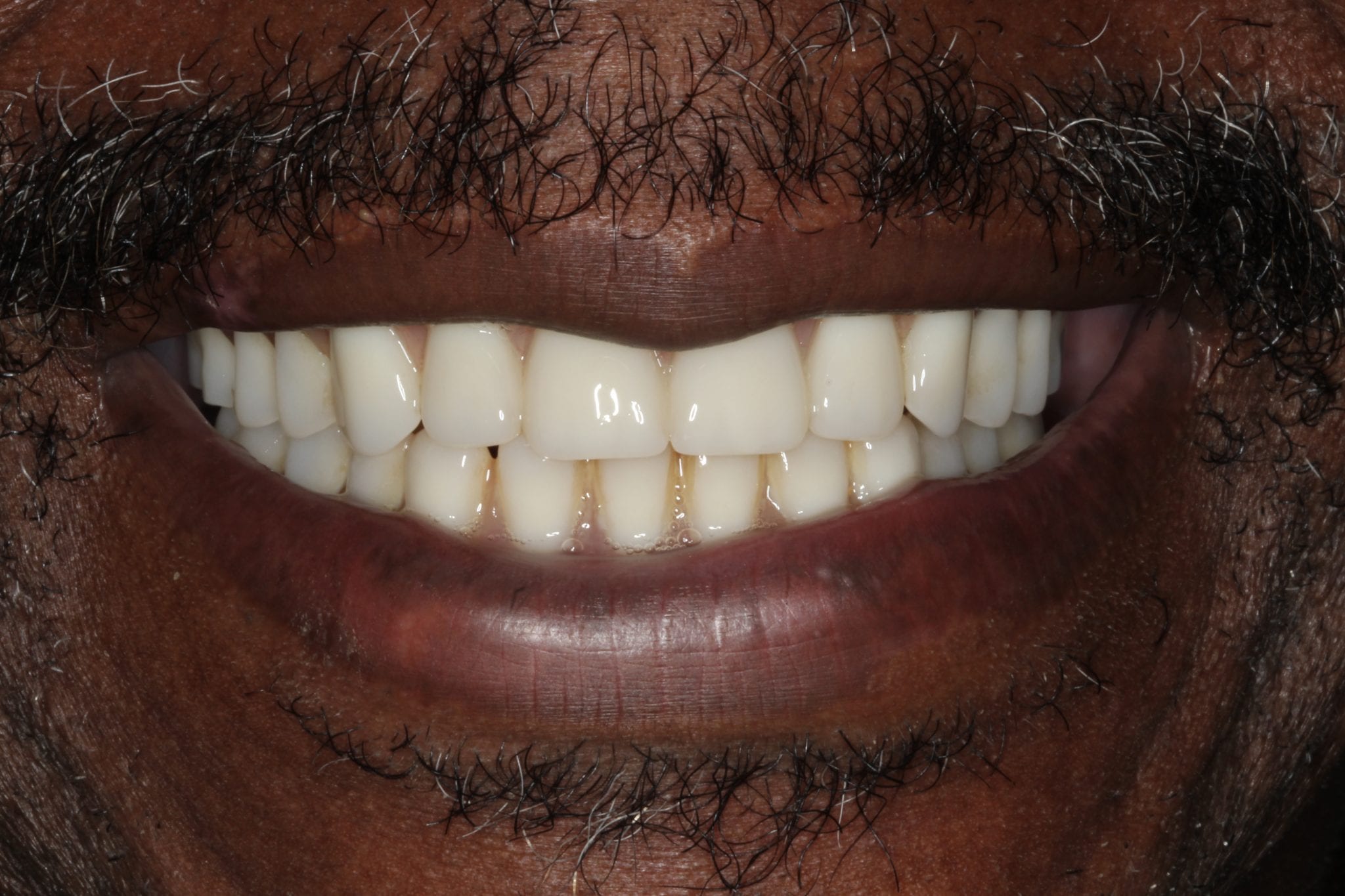 Before & After Results Dental Services | North Texas Dental Surgery