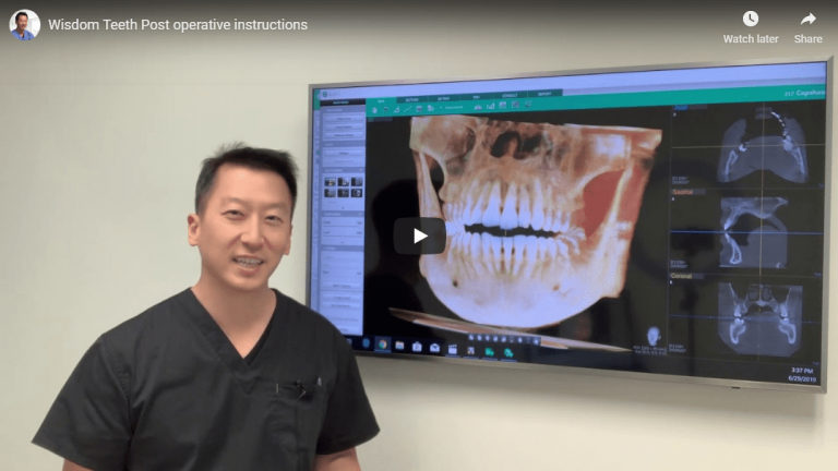 Pointy Bone After Tooth Extraction - North Texas Dental Surgery